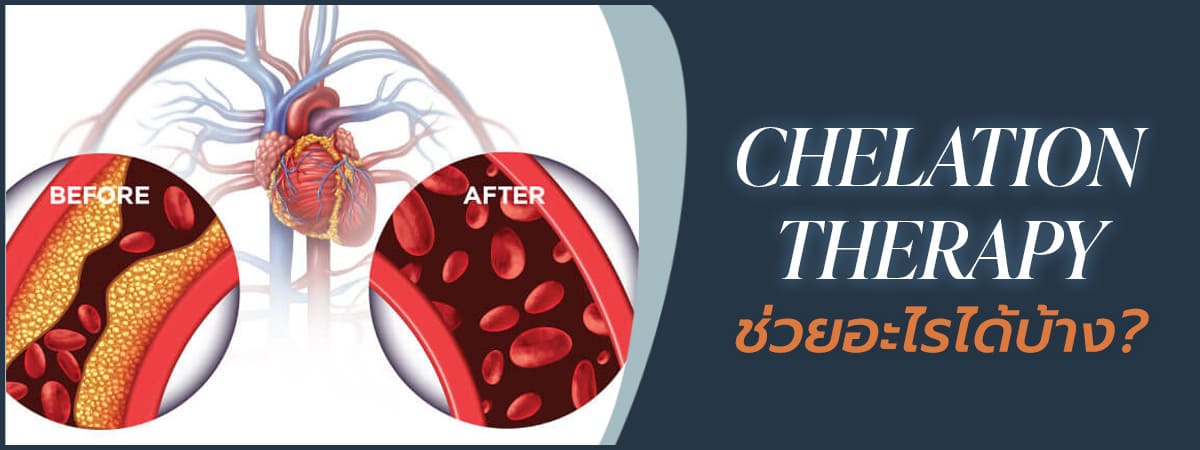 Chelation Therapy – ดีท็อกซ์สารพิษในหลอดเลือดดำ - THE TOUCH EXCLUSIVE