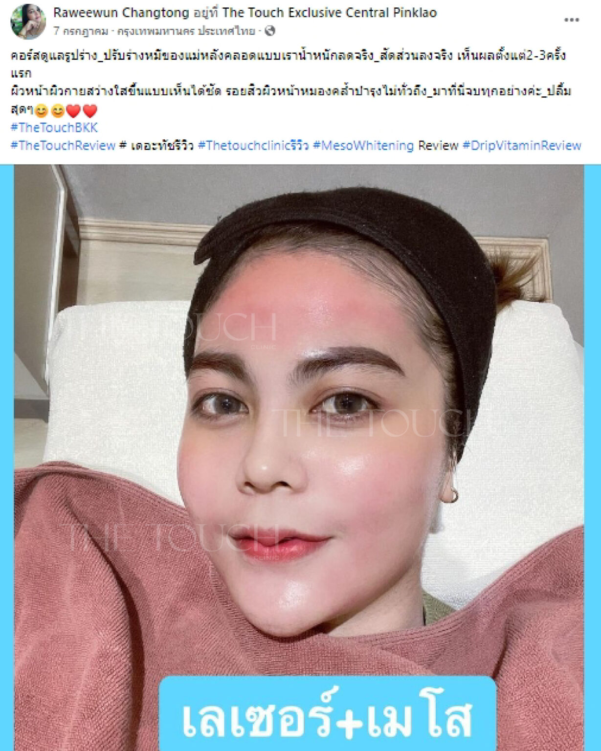 review-meso-whitening