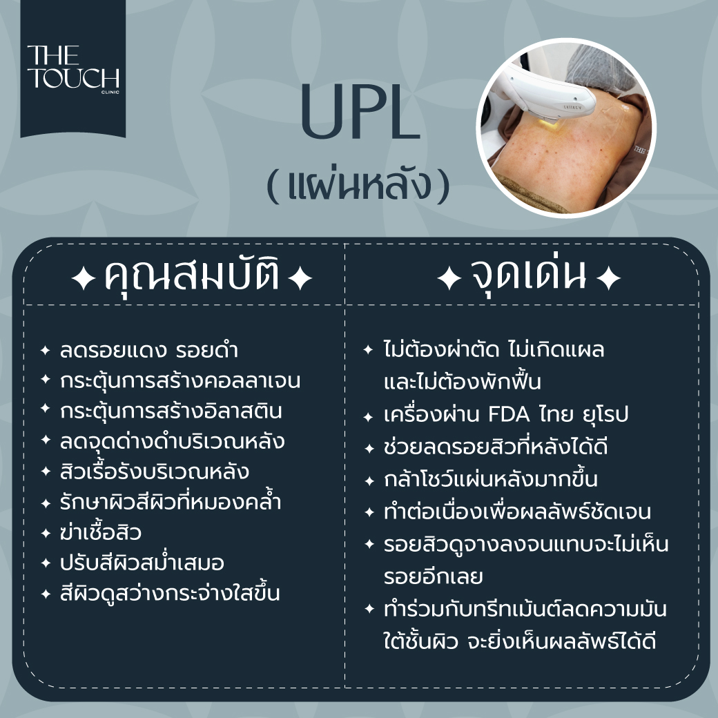 review-upl-ultimate-intensive-pulse-light